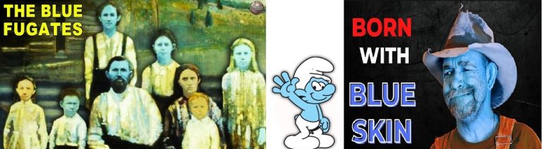 Blue People of Kentucky - Can You Imagine That